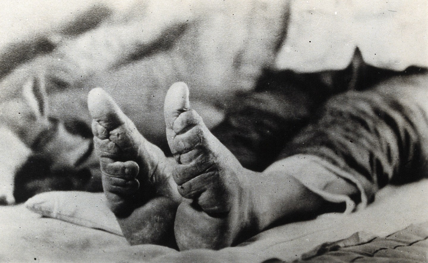 13.4 Chinese Footbinding – Her Half of History