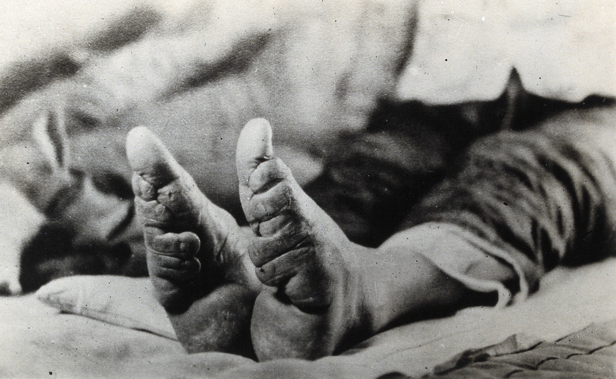 13.4 Chinese Footbinding – Her Half of History
